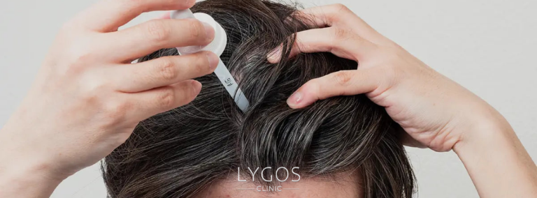 Best Buzz Cuts For A Receding Hairline | Different Types Of Buzz Cuts